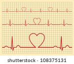 Heart-rate, EKG (ecg), Heart Beat Free Stock Photo - Public Domain Pictures